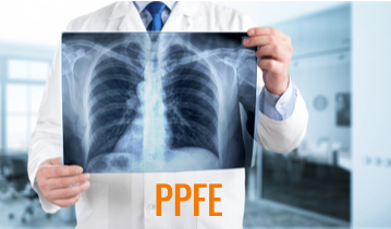 肺MAC症とPPFEの合併は予後不良 : ILD Reports